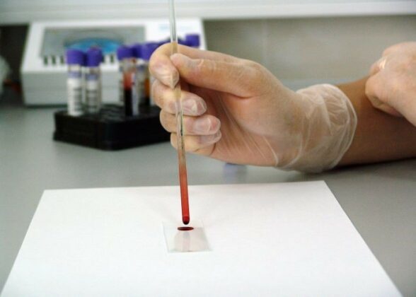 Lab-grown blood administered to people in world-first clinical trial ...